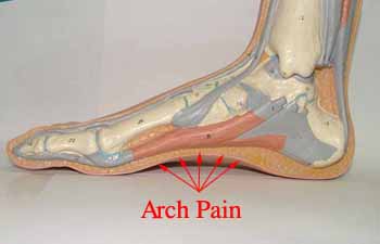 Arch Pain – brightonpodiatry.com.au
